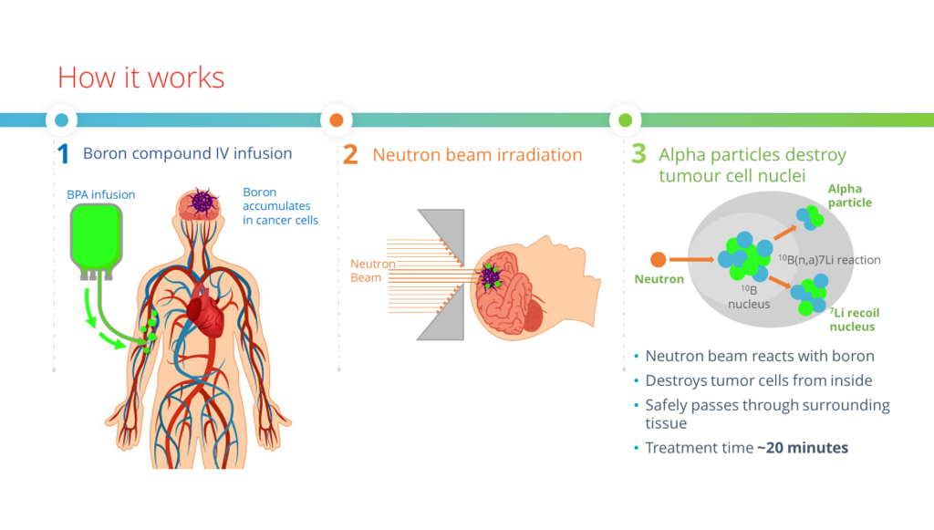 Boron Neutron Capture Therapy: When Drugs and Neutrons Combine - Cosylab